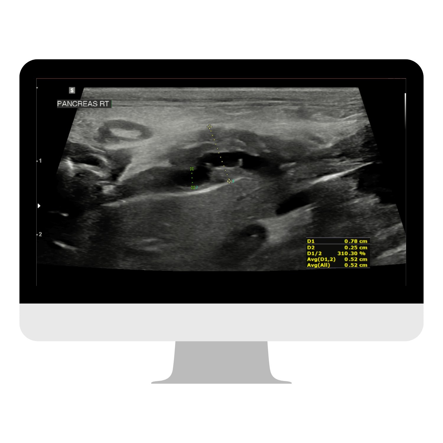 SVS Imaging Teleradiology Sample Reports