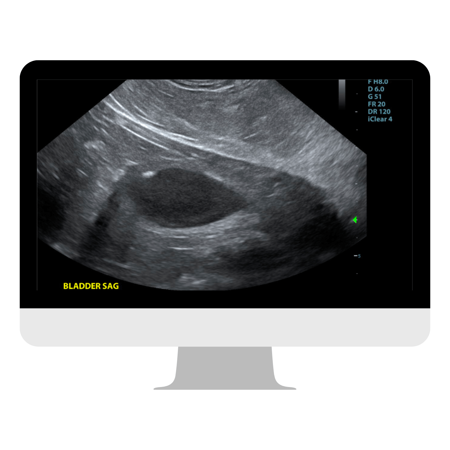 SVS Imaging Teleradiology Sample Reports